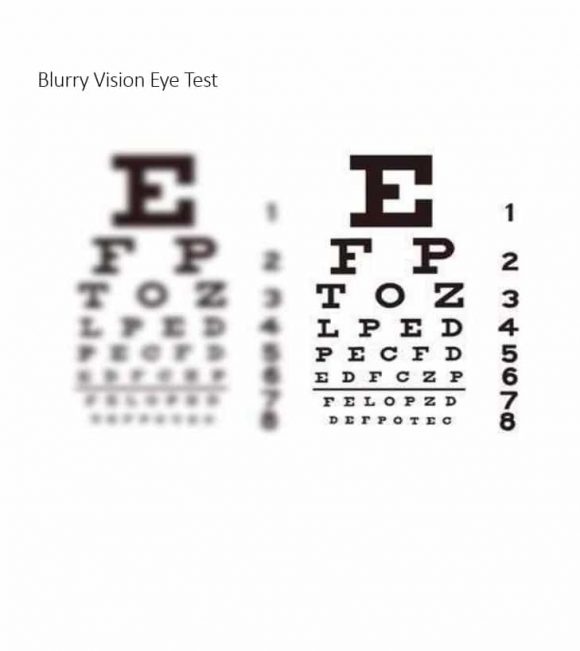 7 Tips for Choosing the Best Chart DMV Eye Test Machine - Imaginative Minds