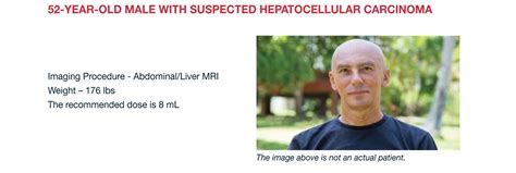 Avoid These Common Mistakes with the Eovist Dosing Chart - Imaginative ...