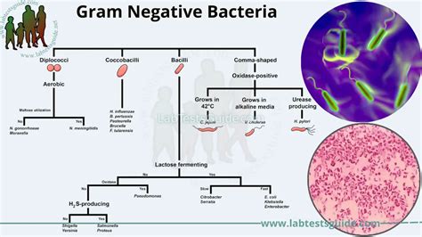 Navigating Bacterial Pathways: A Guide to the Gram Negative Flow Chart ...